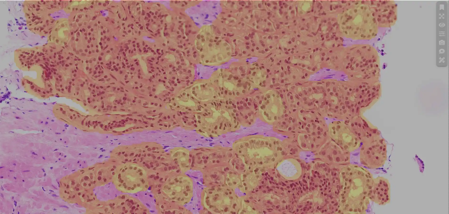 AI Catalog - Tribun Health